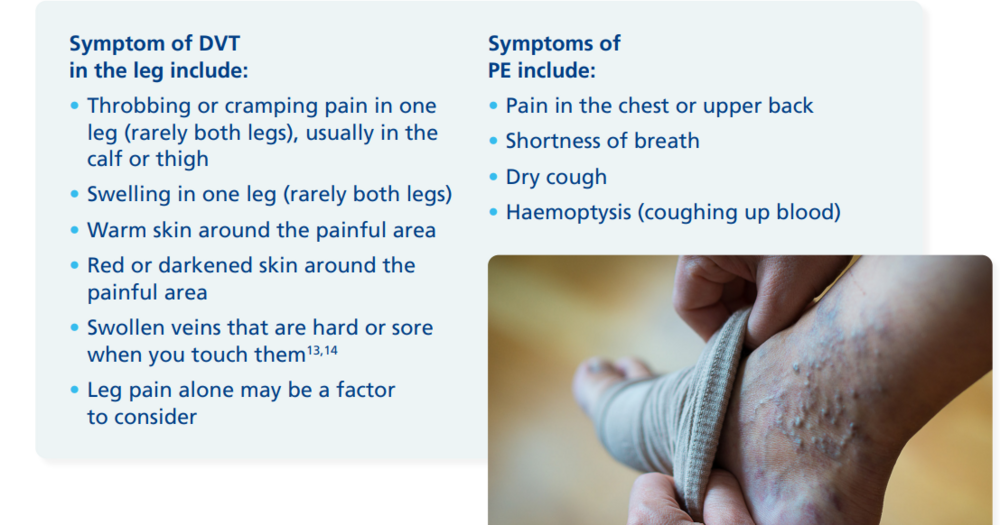 Venous thromboembolism (VTE): deep vein thrombosis and pulmonary ...