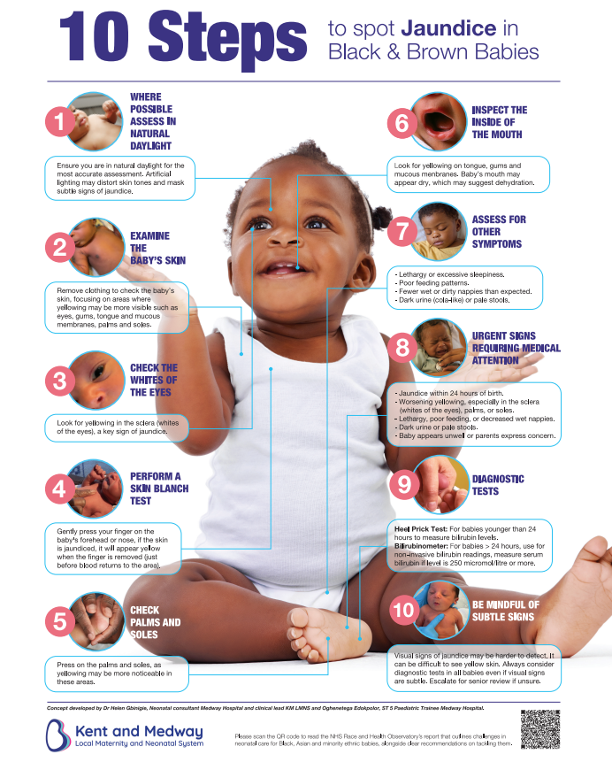 Jaundice Skin Test Baby